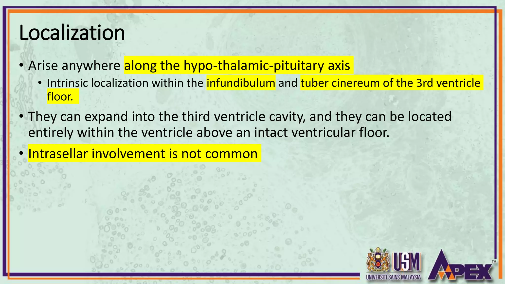 Sellar Region Tumors.pptx