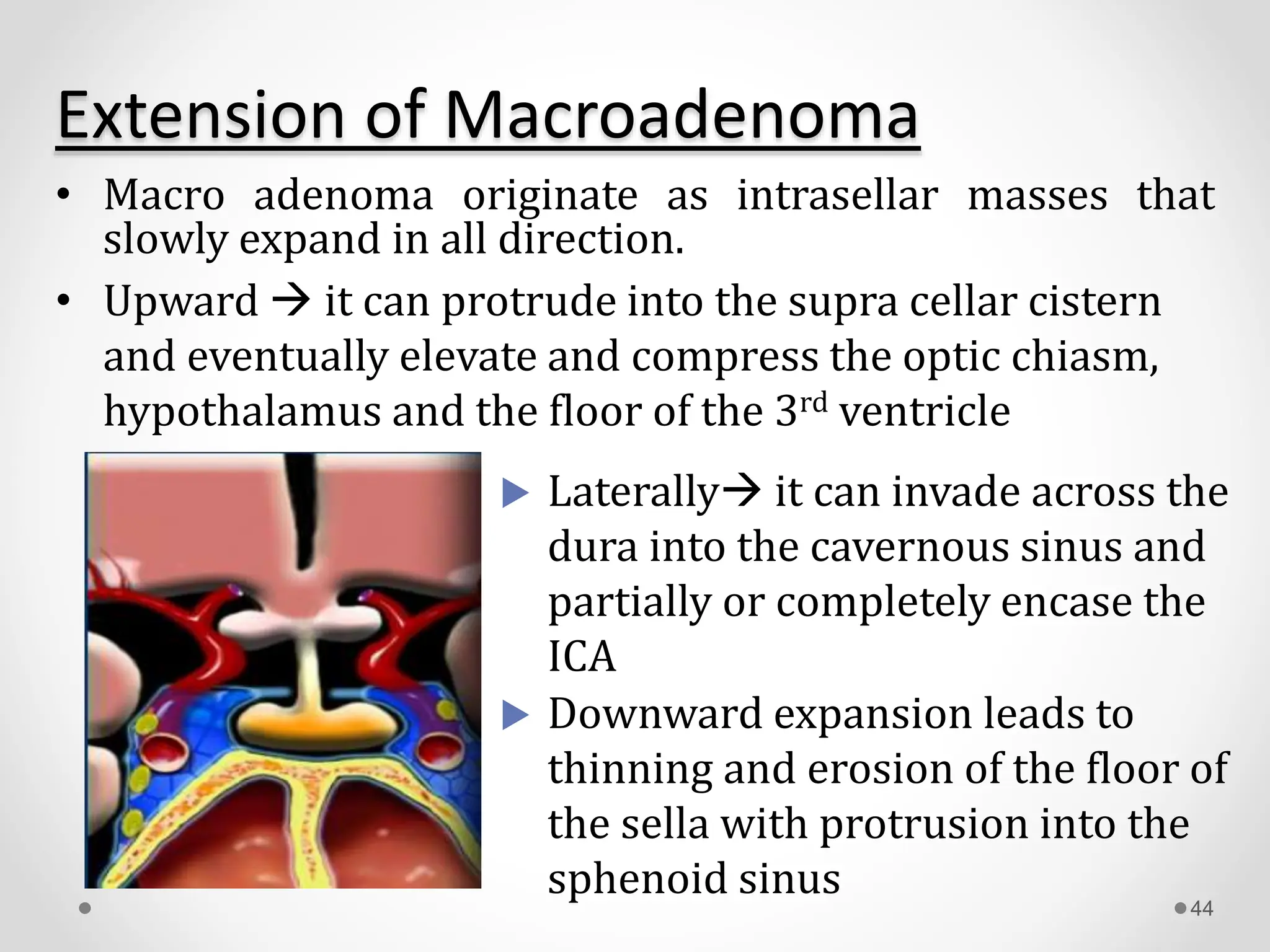Sellar & Suprasellar mass by Deepak.pptx