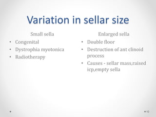 Sellar & Suprasellar mass by Deepak.pptx