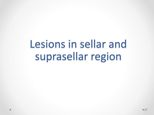 Sellar & Suprasellar mass by Deepak.pptx