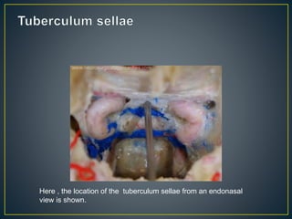 Sella supra sella anatomy | PPTX