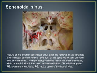 Sella supra sella anatomy | PPTX