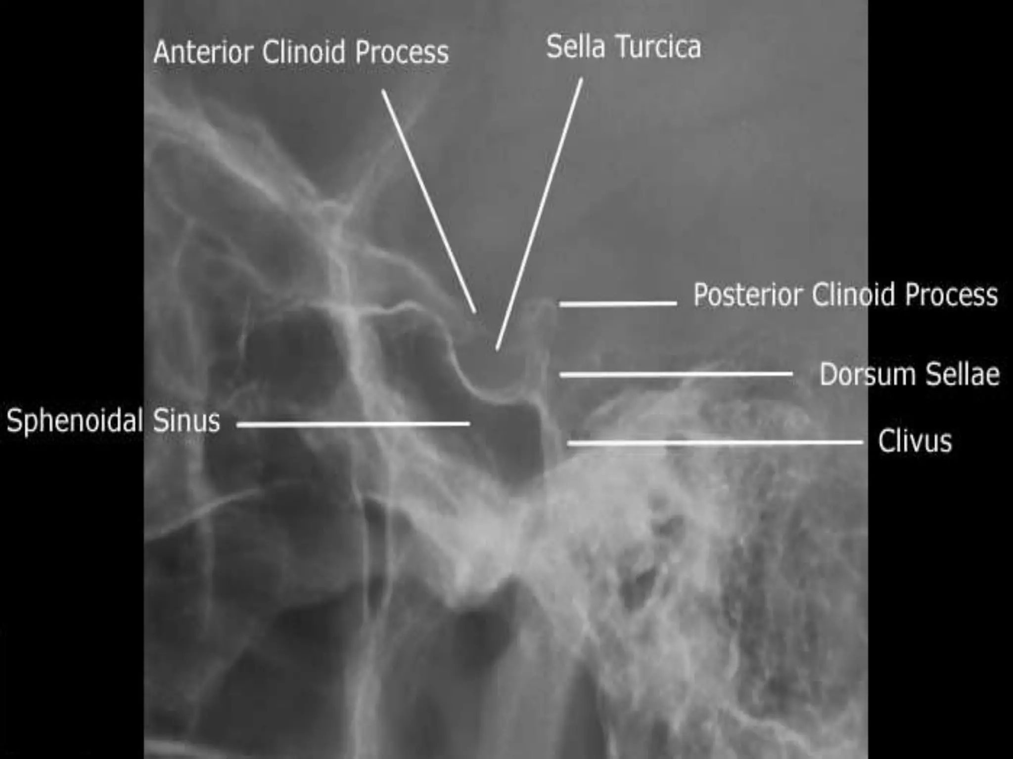 Sella Turcica (RAD32) | PPTX