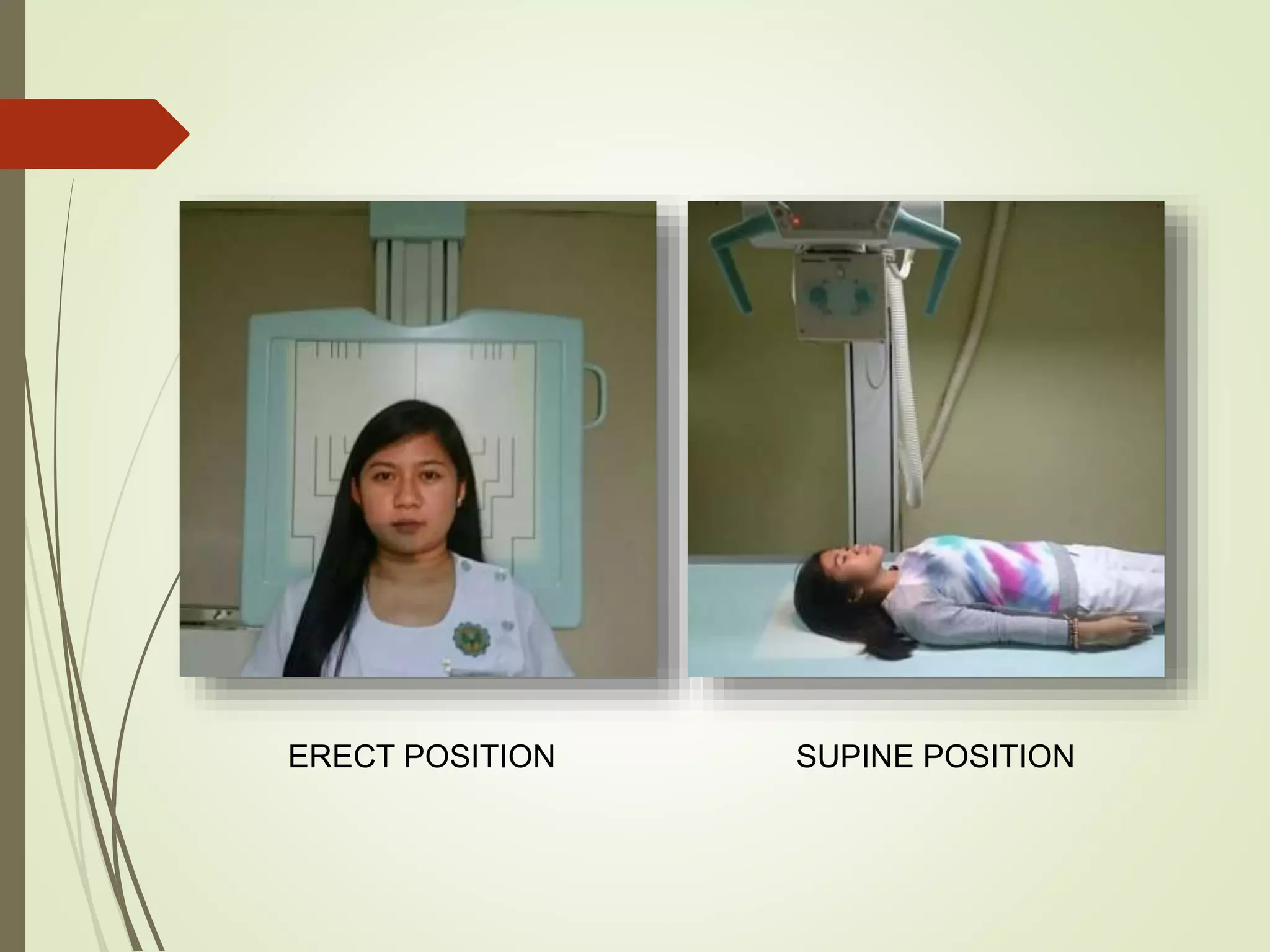 Sella Turcica (RAD32) | PPTX