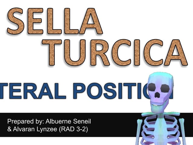 Sella Turcica (RAD32) | PPTX | Bone and Joint Conditions | Diseases and ...