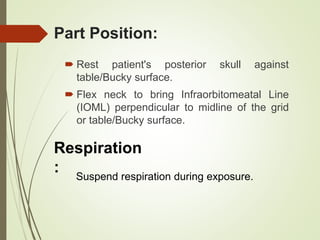 Sella Turcica (RAD32) | PPTX