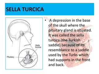 Sella Turcica Diagram
