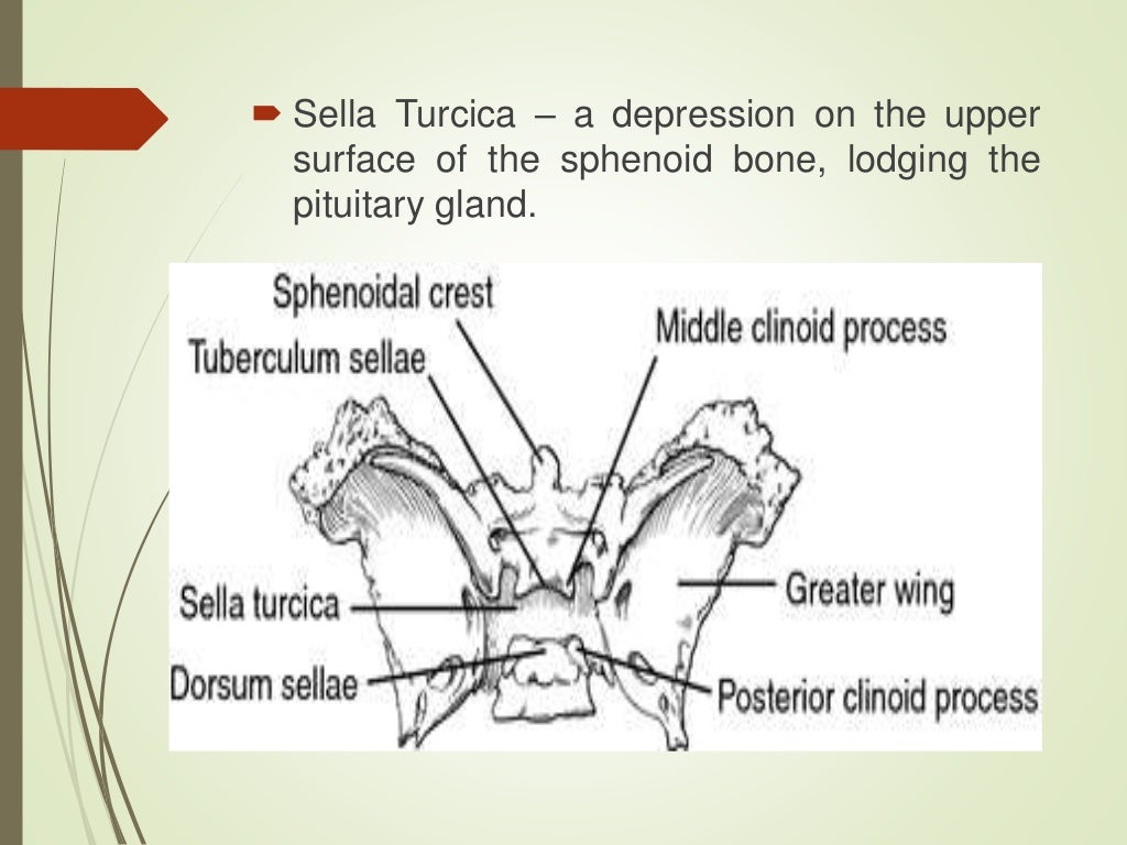 Sella Turcica (RAD32)