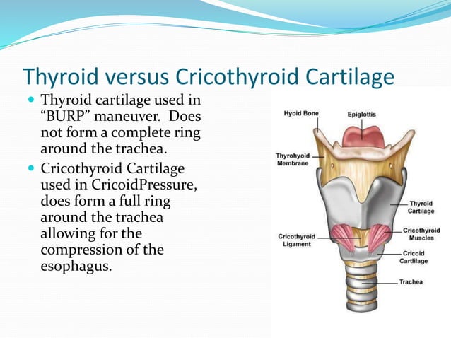 sellick maneuver, BURP , OELM | PPTX