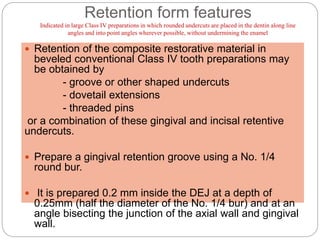 Class III, IV, V Cavity preparations for Composites- SELVI | PPTX