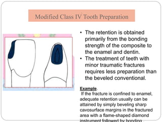Class III, IV, V Cavity preparations for Composites- SELVI | PPTX