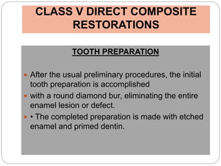 Class III, IV, V Cavity preparations for Composites- SELVI | PPTX