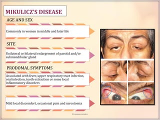 Mikulicz Disease