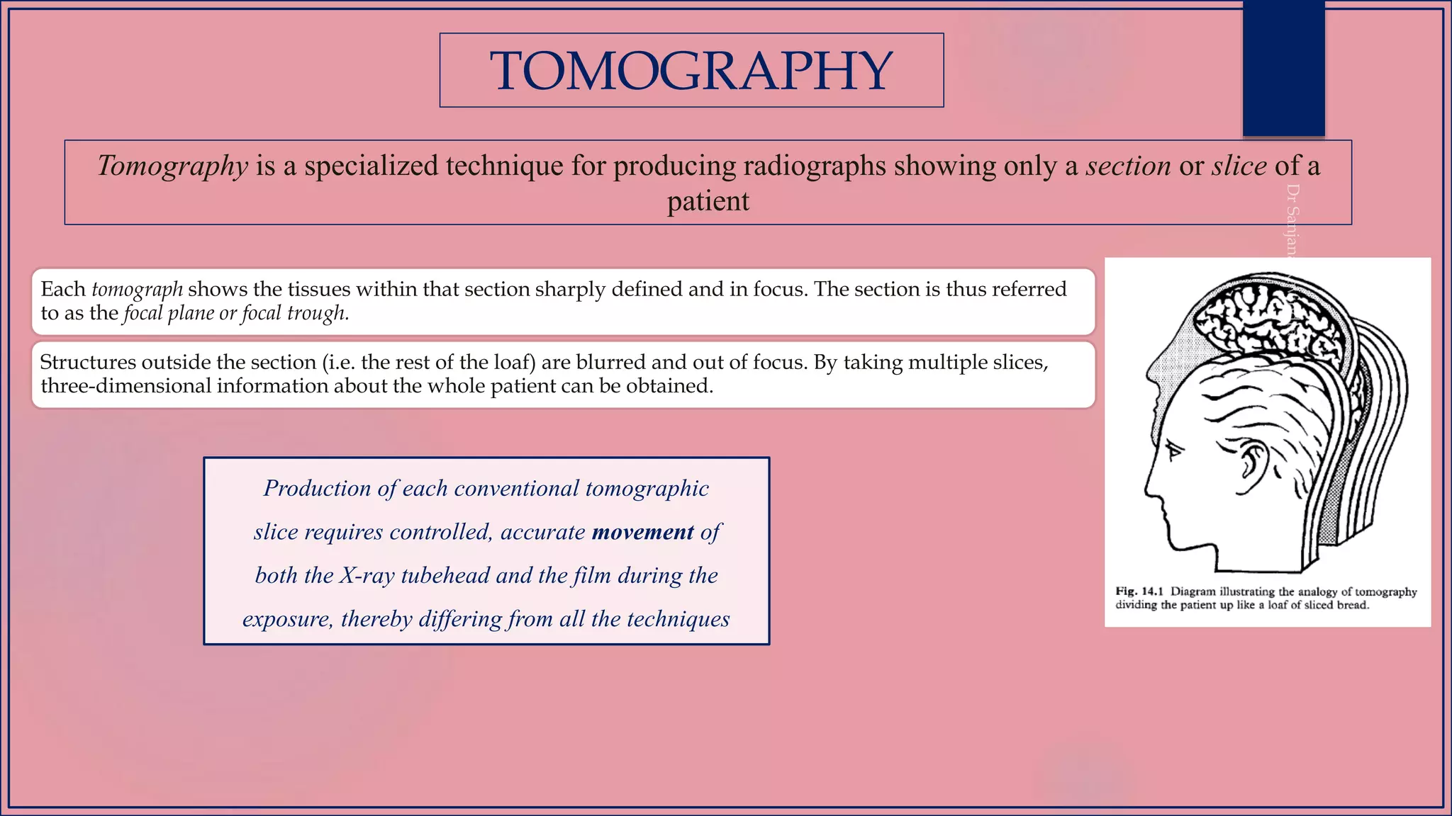 Panoramic radiography OPG | PPTX