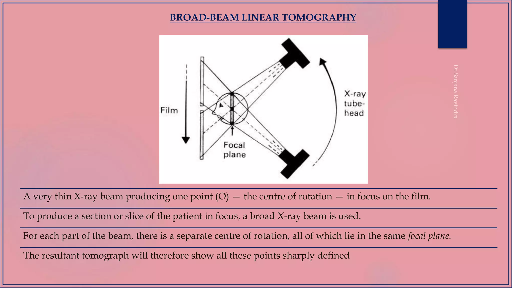 Panoramic radiography OPG | PPTX