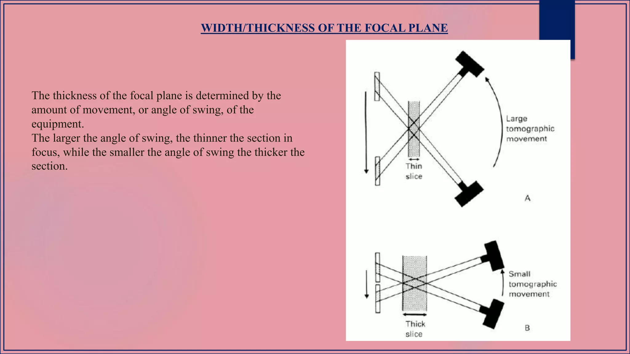 Panoramic radiography OPG | PPTX