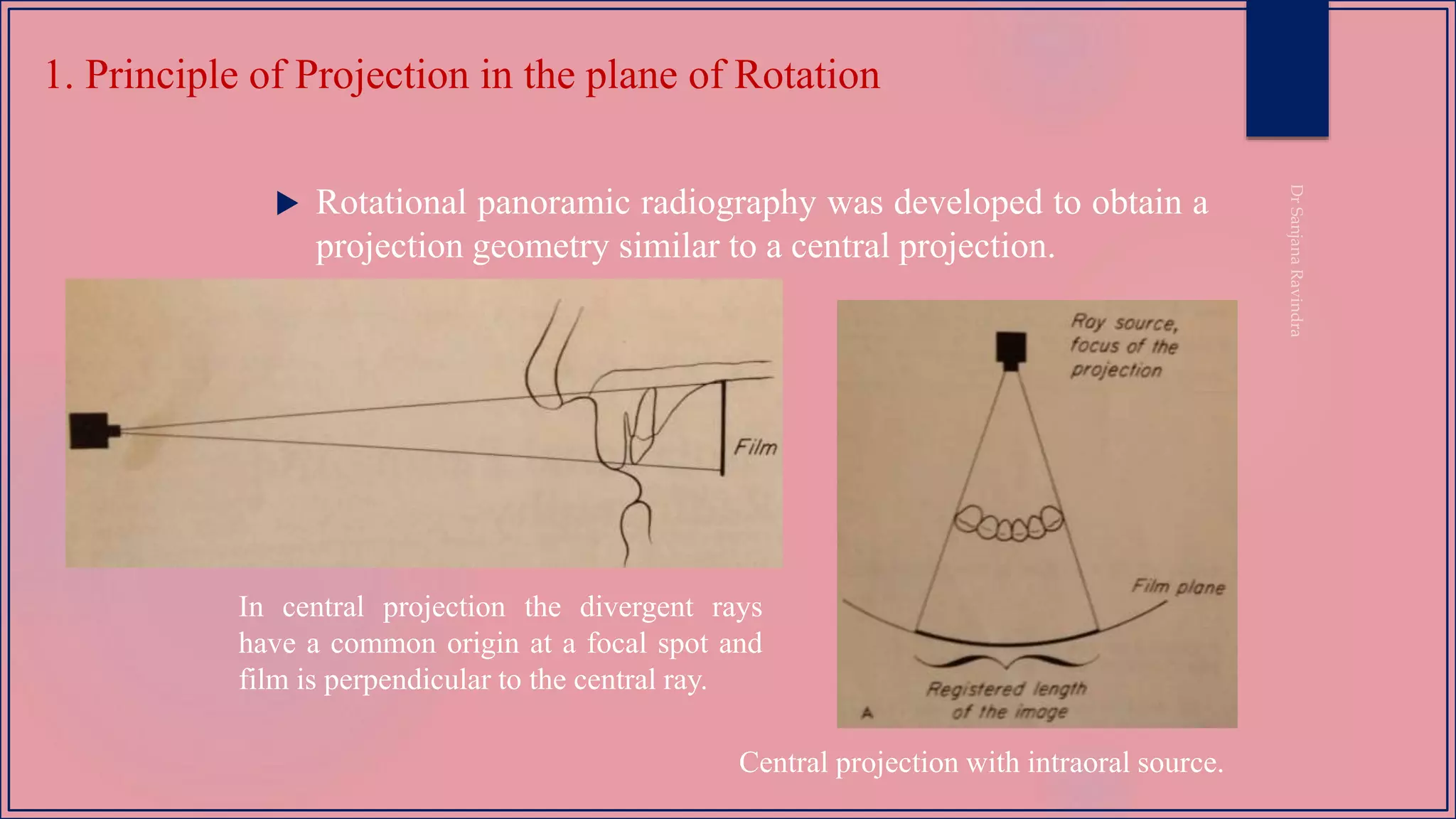 Panoramic radiography OPG | PPTX