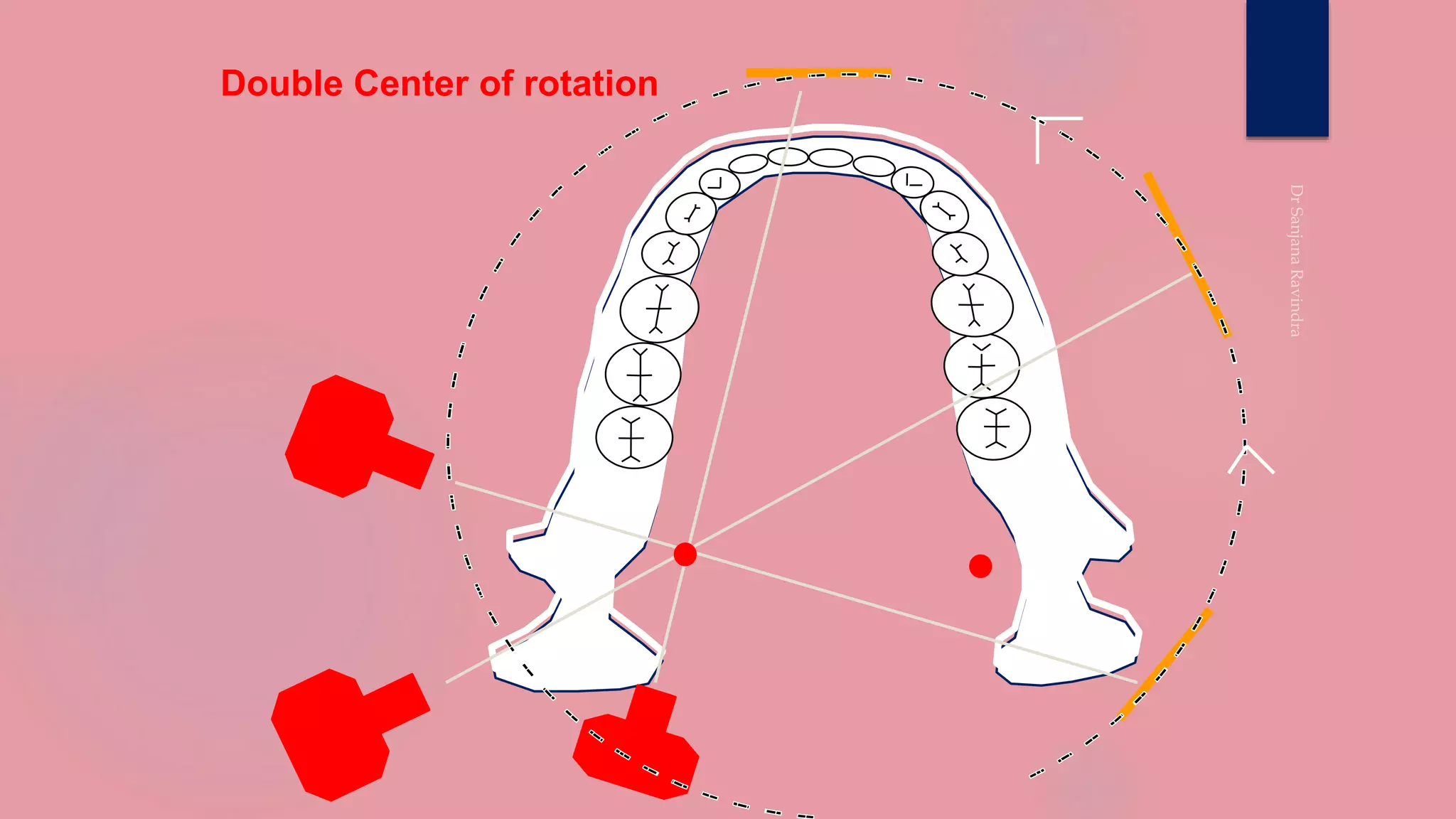 Panoramic radiography OPG | PPTX