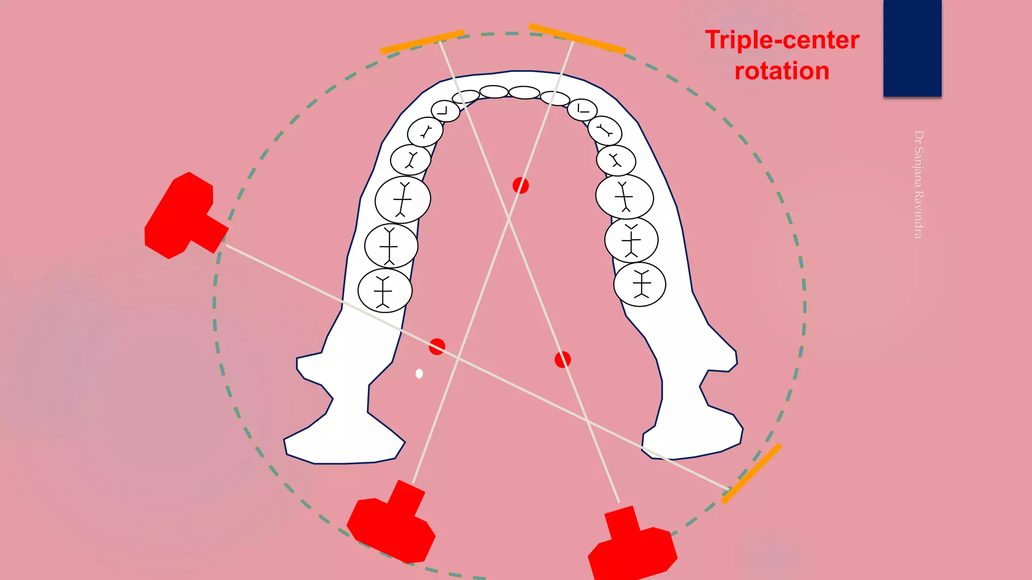 Panoramic radiography OPG | PPTX