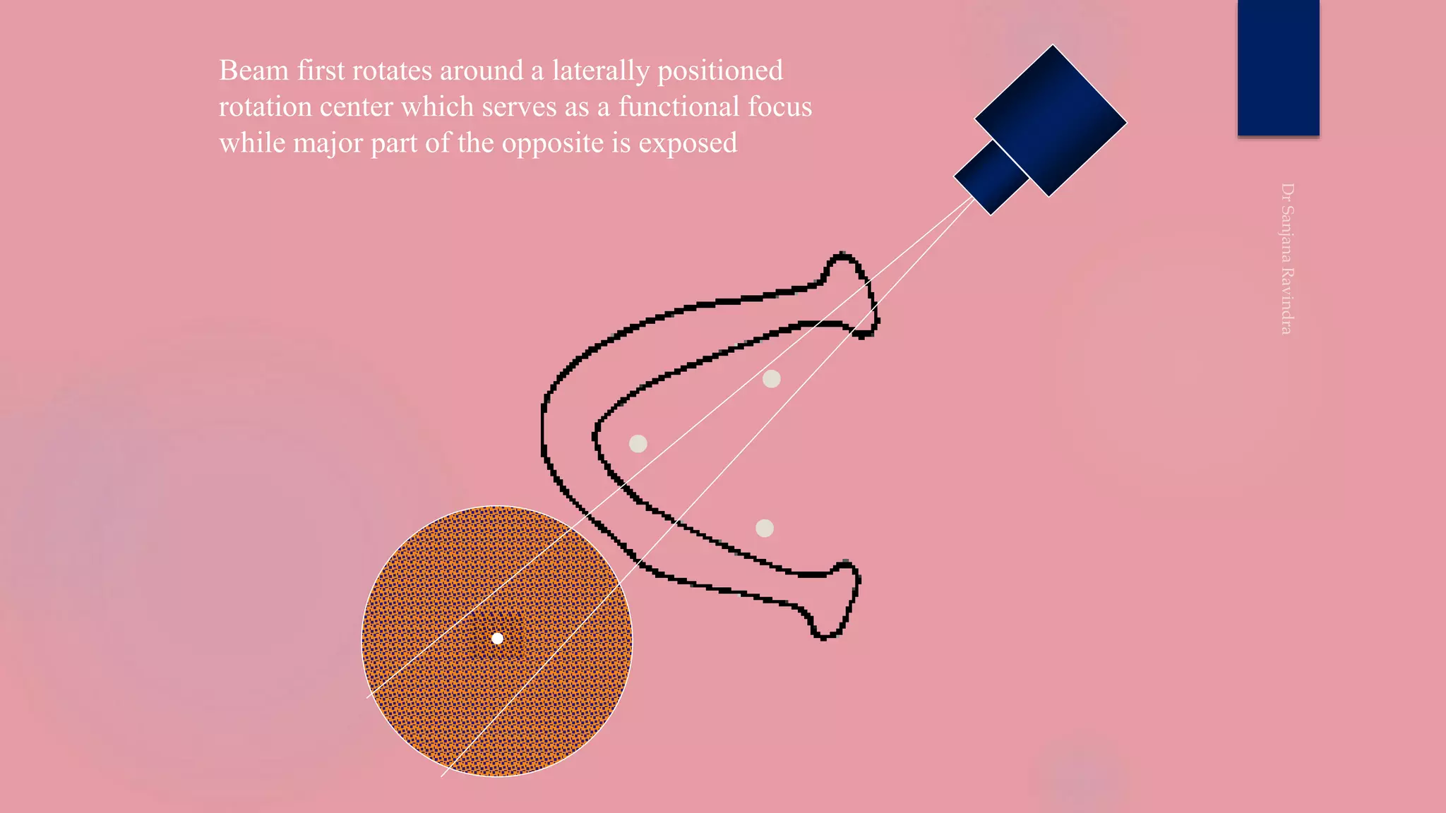 Panoramic radiography OPG | PPTX