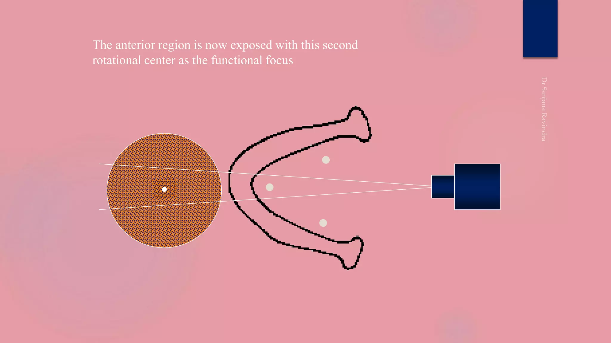 Panoramic radiography OPG | PPTX