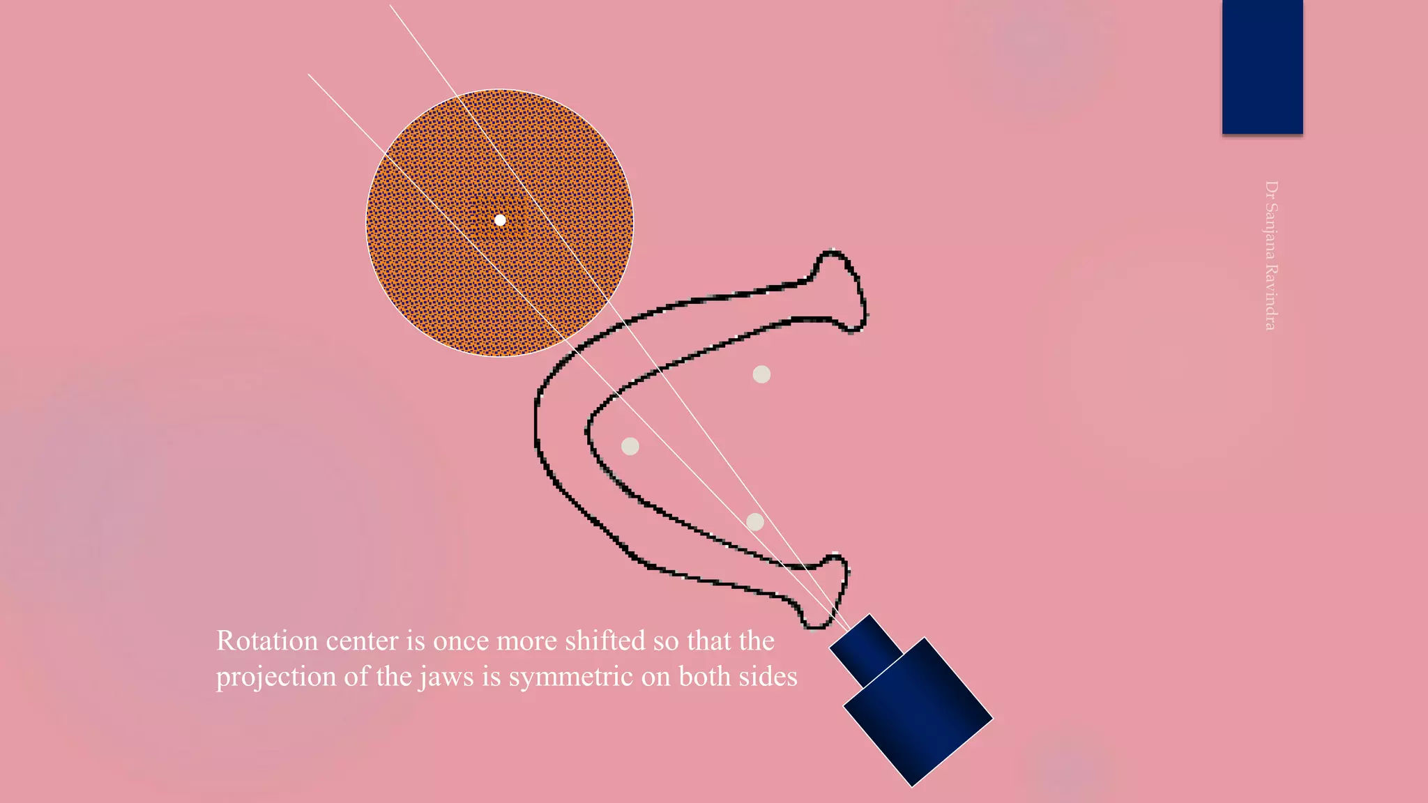 Panoramic radiography OPG | PPTX