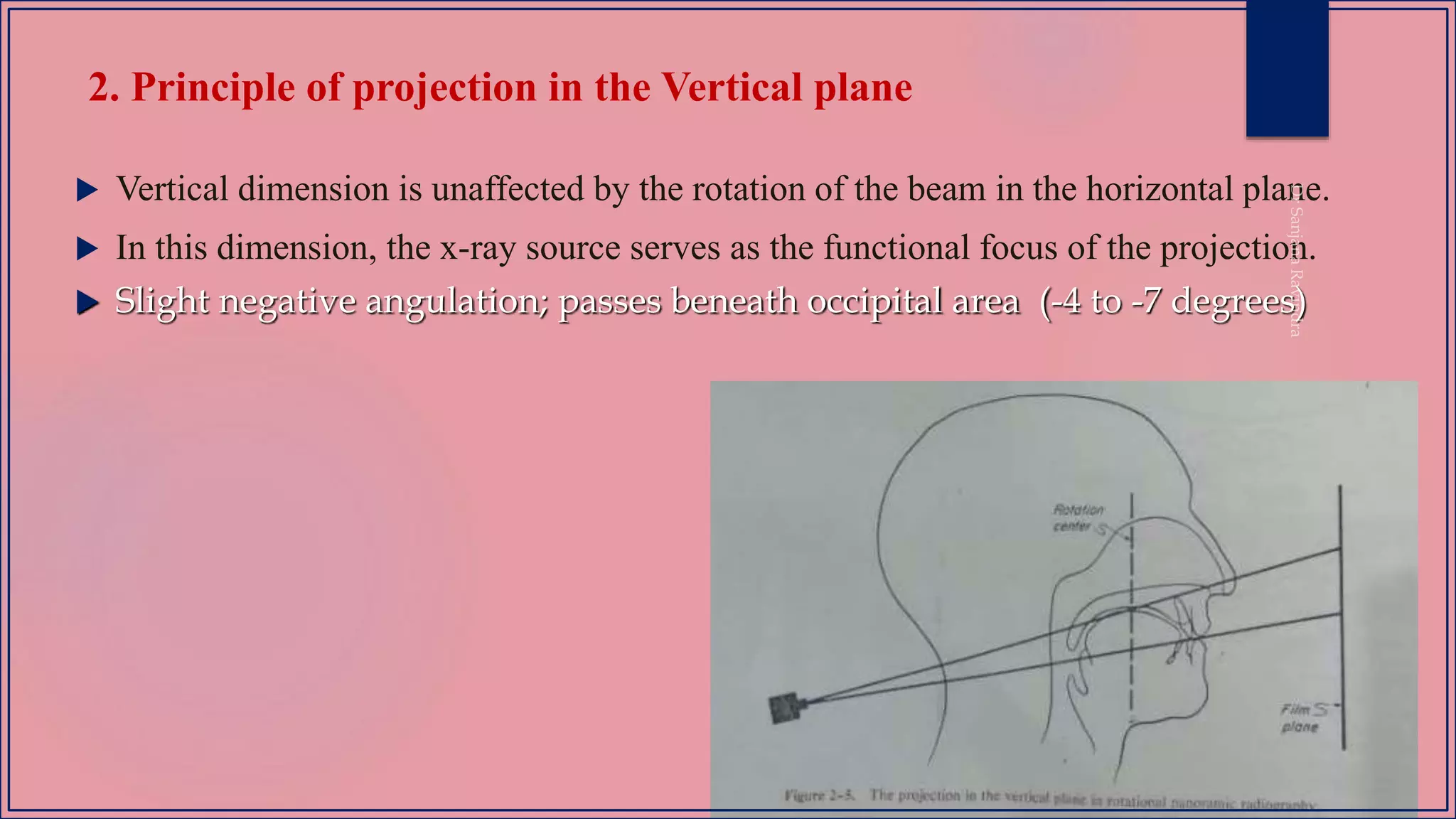 Panoramic radiography OPG | PPTX