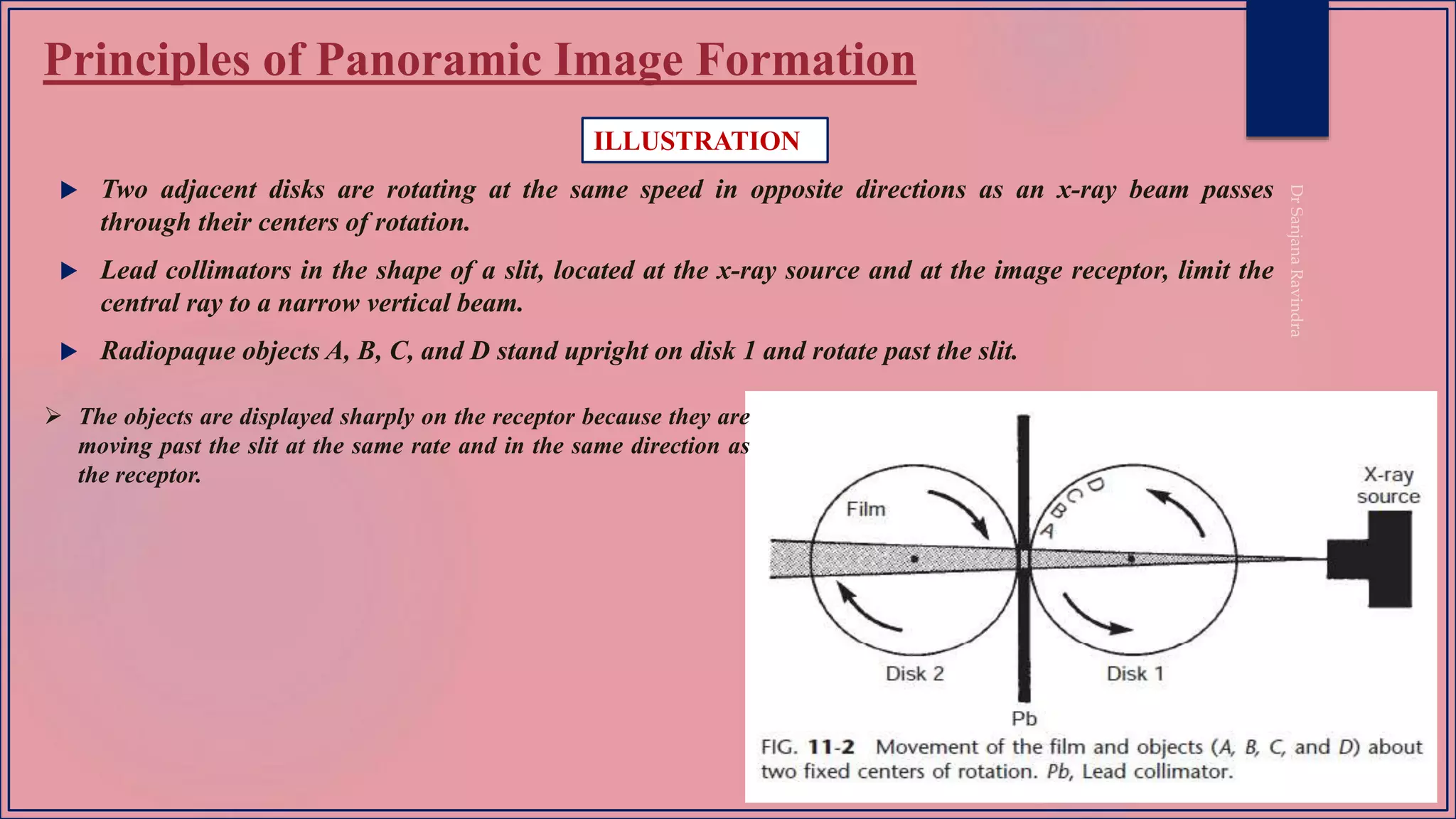 Panoramic radiography OPG | PPTX