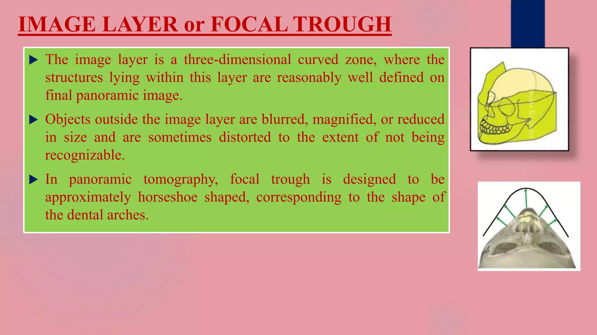 Panoramic radiography OPG | PPTX