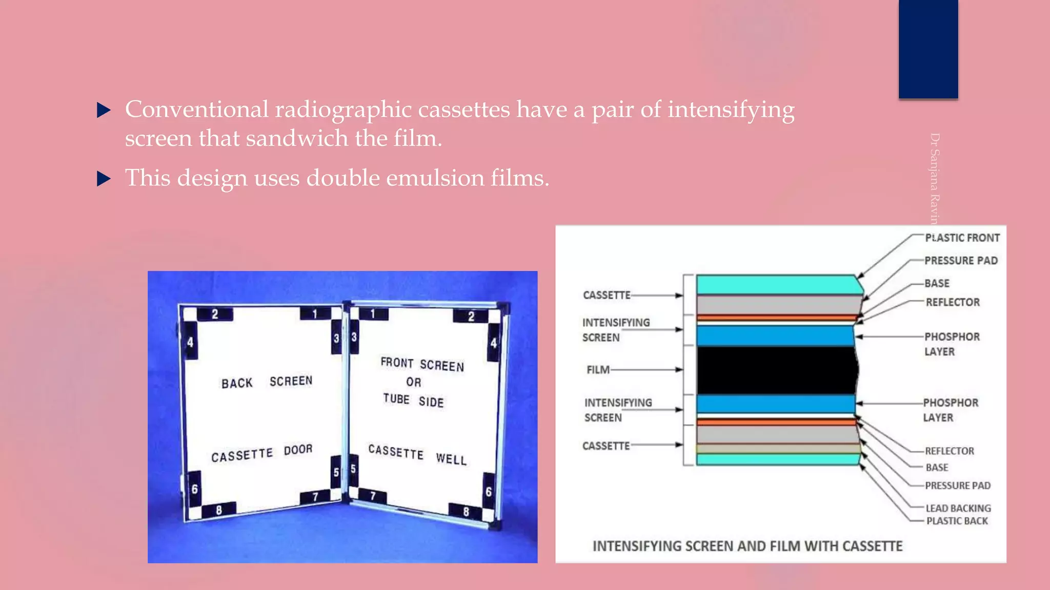Panoramic radiography OPG | PPTX