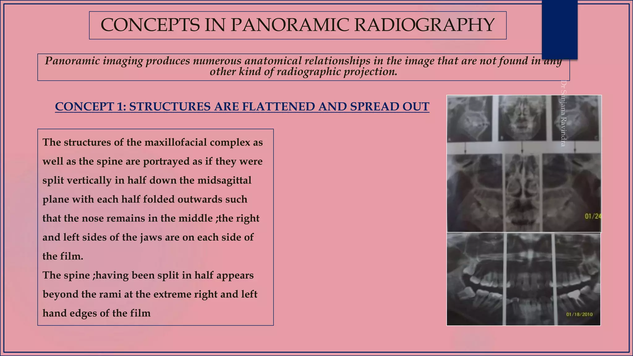 Panoramic radiography OPG | PPTX