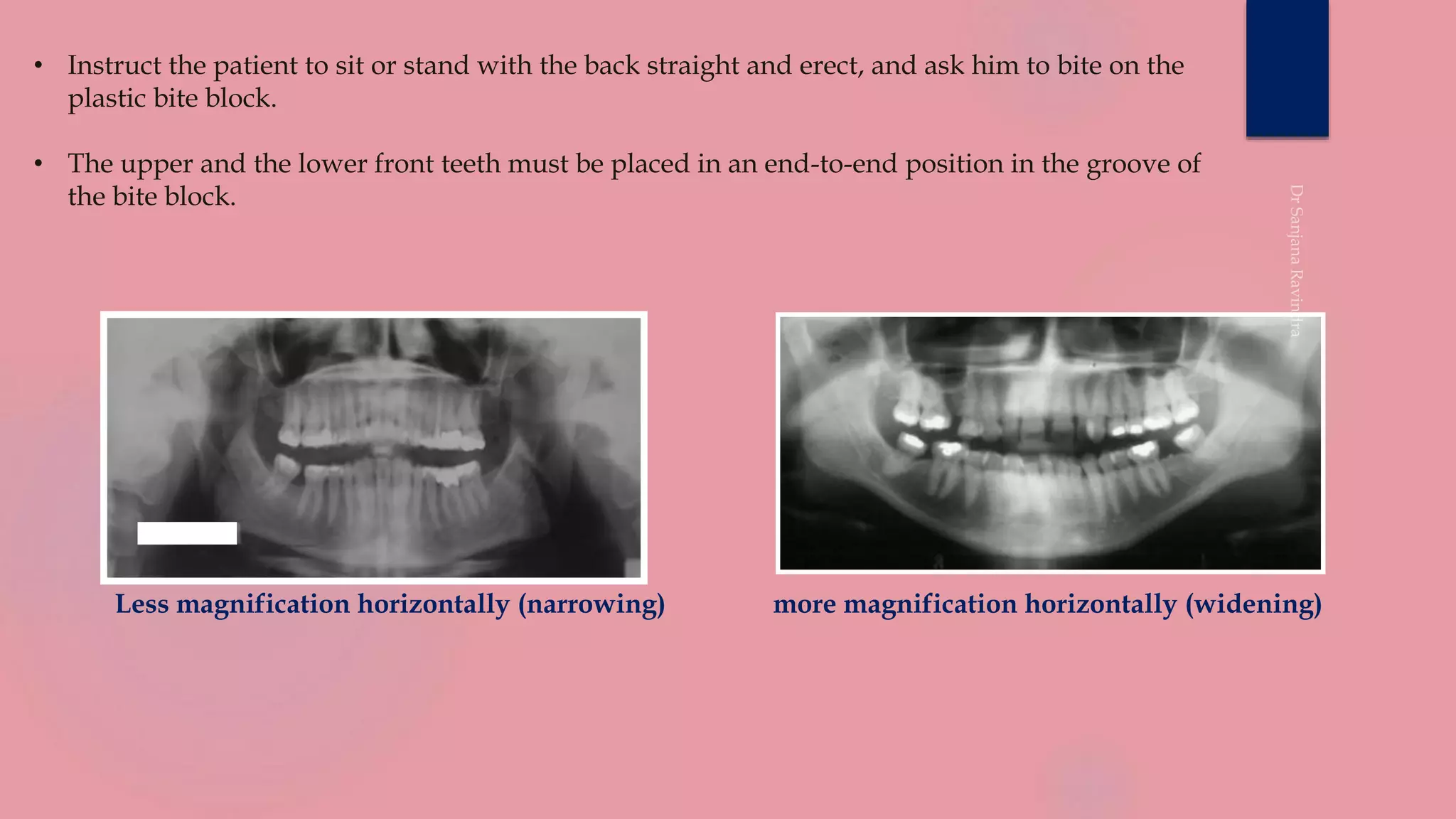 Panoramic radiography OPG | PPTX
