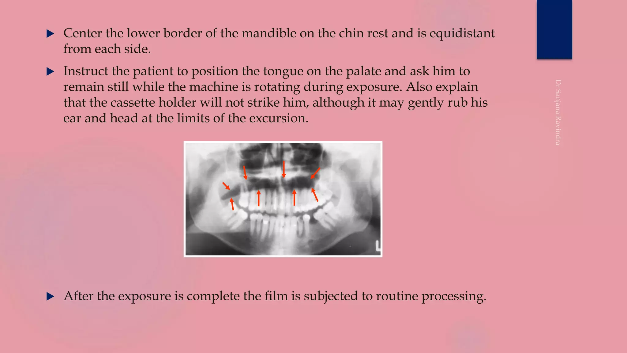Panoramic radiography OPG | PPTX