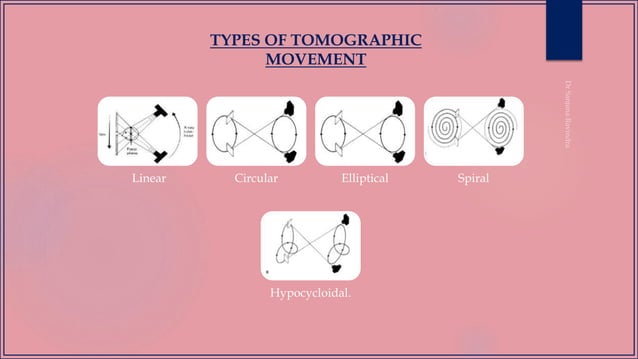 Panoramic radiography OPG | PPTX