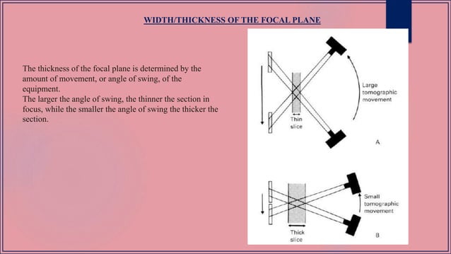 Panoramic radiography OPG | PPTX