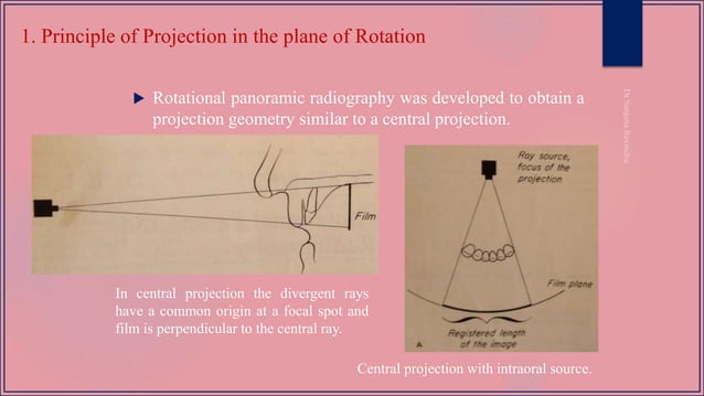 Panoramic radiography OPG | PPTX