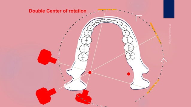 Panoramic radiography OPG | PPTX