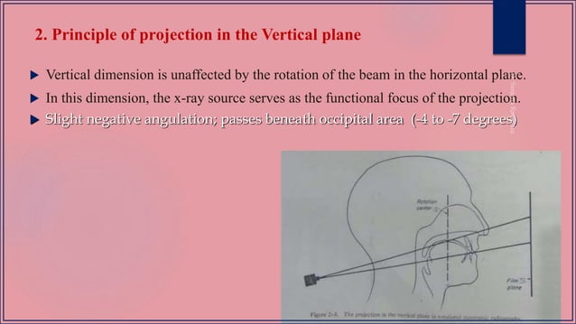 Panoramic radiography OPG | PPTX