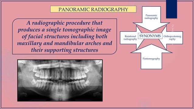 Panoramic radiography OPG | PPTX