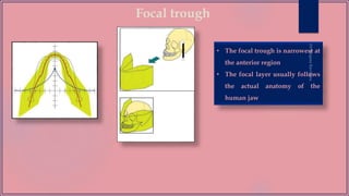 Panoramic radiography OPG | PPTX