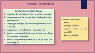 Panoramic radiography OPG | PPTX