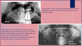 Panoramic radiography OPG | PPTX