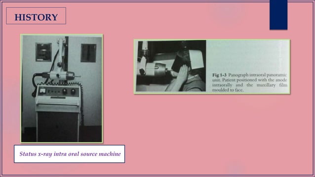 Panoramic radiography OPG | PPTX