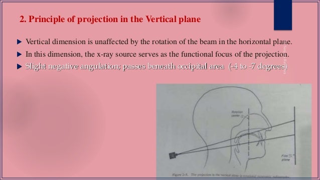Panoramic radiography OPG