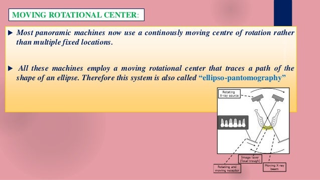 Panoramic radiography OPG
