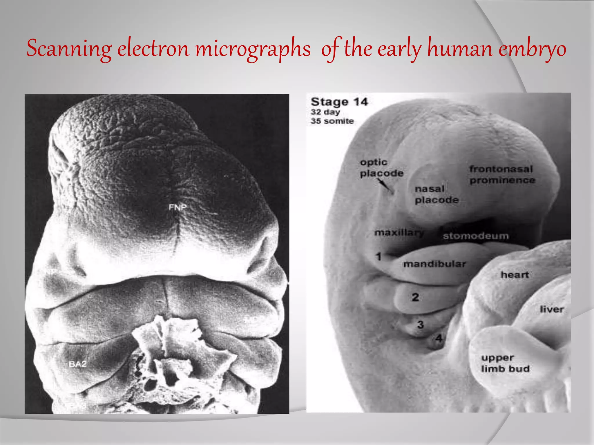 Scanning Electron Microscope (SEM) | PPTX