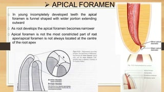 Apical Foramen