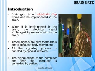 Braingate | PPT