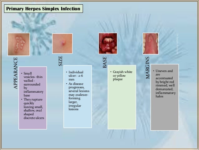 Herpes Simplex viral Infection - Dr Sanjana Ravindra