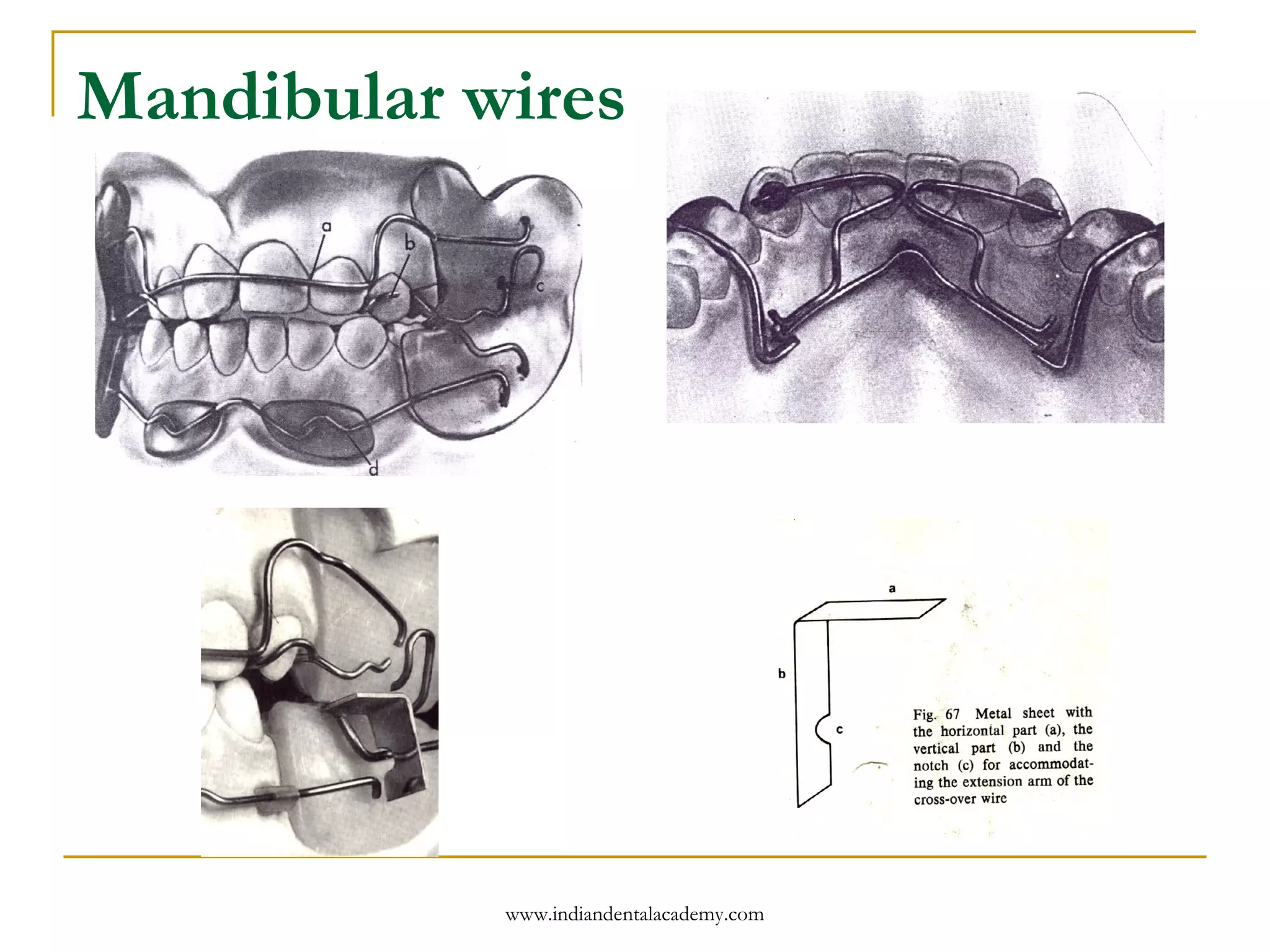 FRANKEL FUNCTION REGULATOR | PPT | Dental Health | Diseases and Conditions